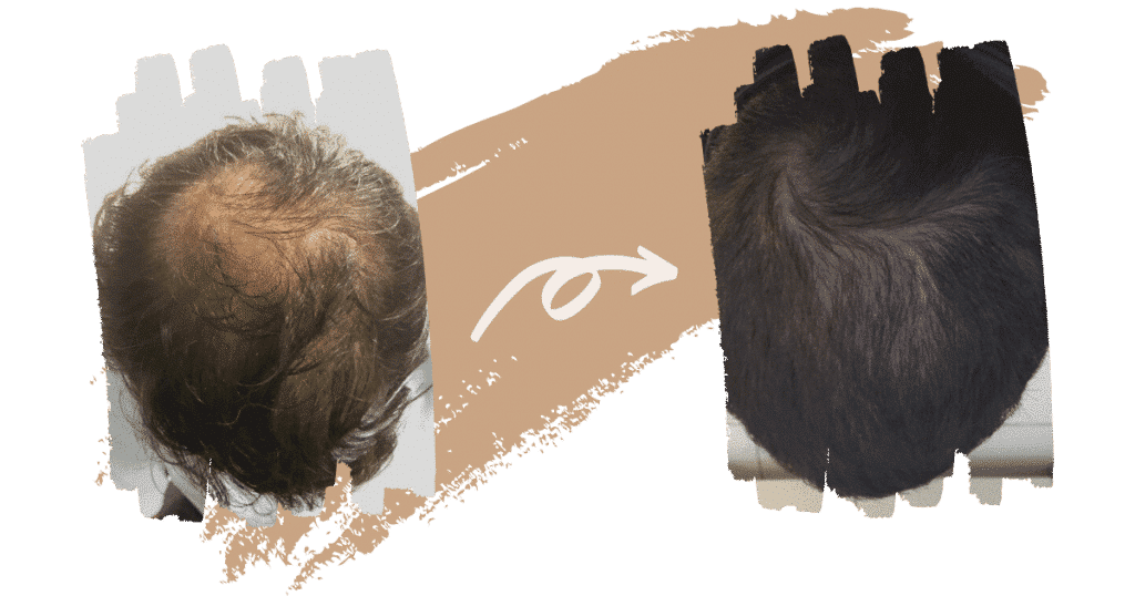 SHIFT Hair Turkiye | Self-love is a Superpower!